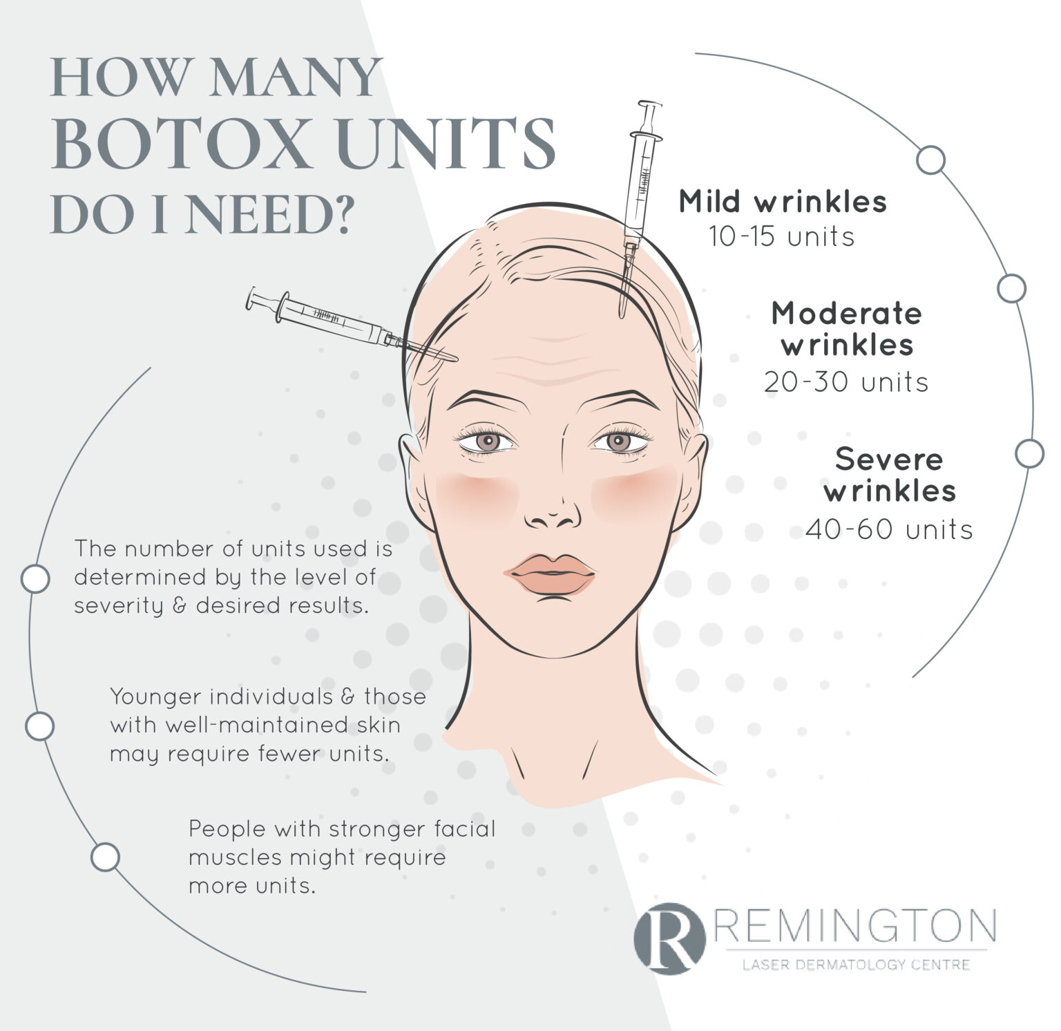 How Many Units of Botox Are Needed for Forehead?