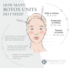 How Many Units of Botox Are Needed for Forehead?